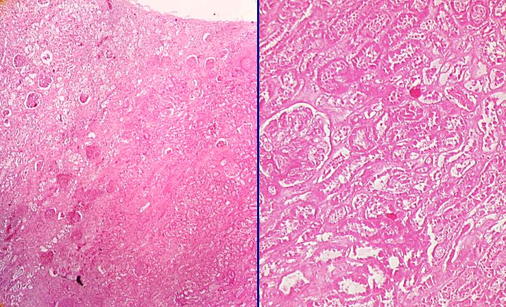 Histo Makro Pathologie Basic