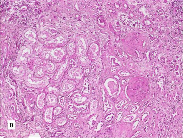 Histo Makro Pathologie Basic