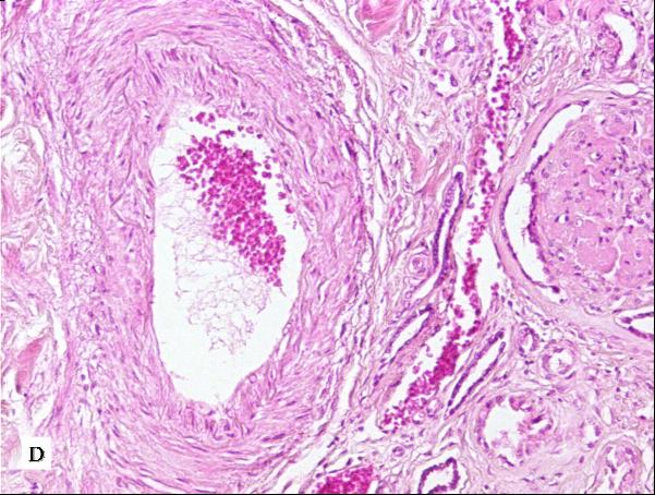 Histo Makro Pathologie Basic