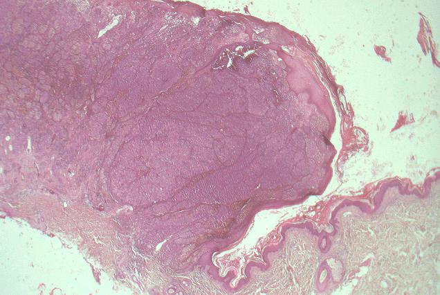 Histo Makro Pathologie Basic