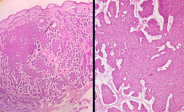Histo Makro Pathologie Basic